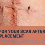 What to Expect In Your First Week After a Total Knee Replacement