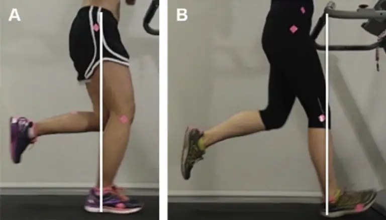 Running with Patellofemoral Syndrome: What You Need to Know - Best ...
