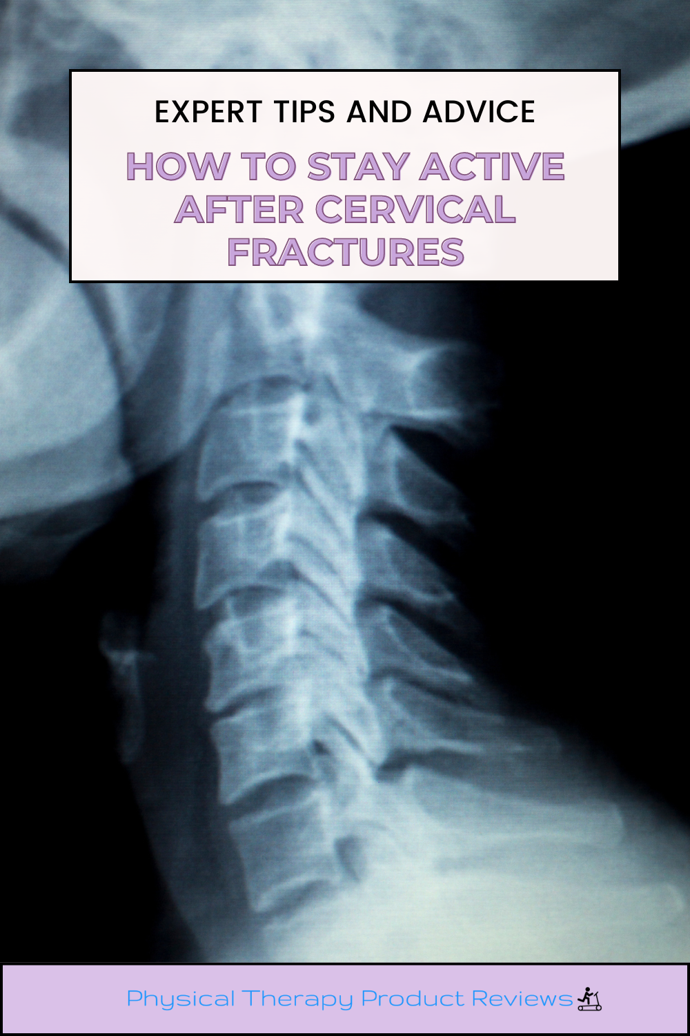 How to Stay Active After Cervical Fractures: Expert Tips and Advice ...